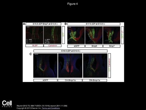 Youngshik Choe Julie A Siegenthaler Samuel J Pleasure Neuron Ppt Download