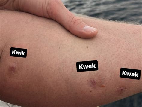 Kwak De Menselijke Botvlieg Avonturia