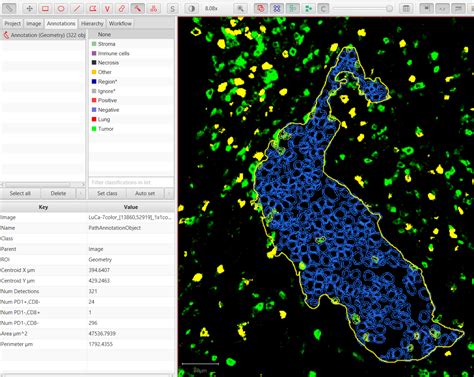 github gico1941 qupath image quantification pipeline a pipeline for