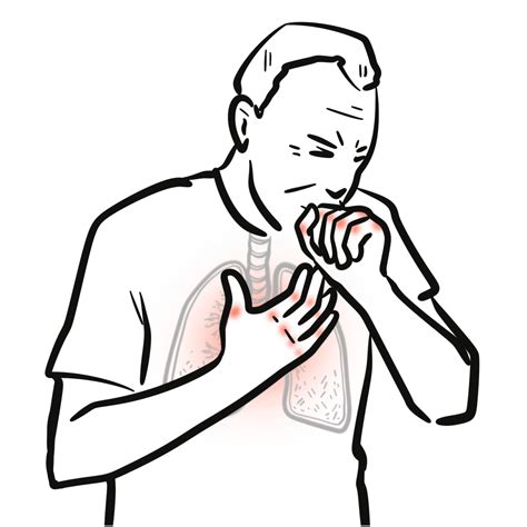 Caplan Syndrome Armando Hasudungan