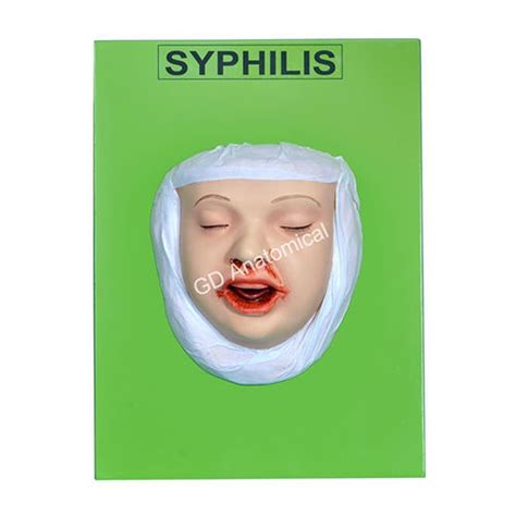 Syphilis Model Color Natural At Best Price In Ambala Cantt G D
