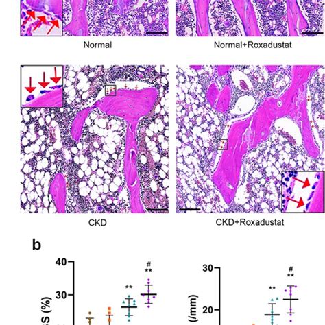 Effects Of Roxadustat On Osteoclast Related Parameters Of Trabecular Download Scientific