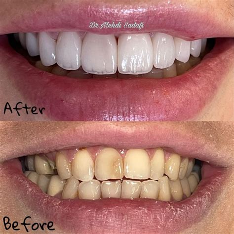 Mehdi Sadafi Posted On Linkedin