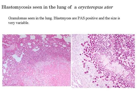 Niahniah Pathogenic Organisms Observed By Electron Microscope