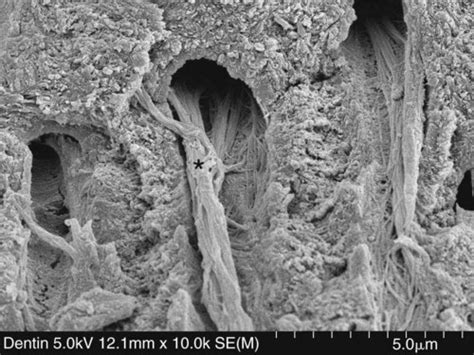 4 Fundamental Concepts Of Enamel And Dentin Adhesion Pocket Dentistry