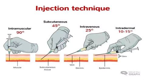 Types Of Injection Pptx Types Of Injection Pptx