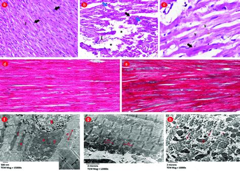Light Micrographs Stained By Hematoxylin And Eosin Hande A Control Download Scientific