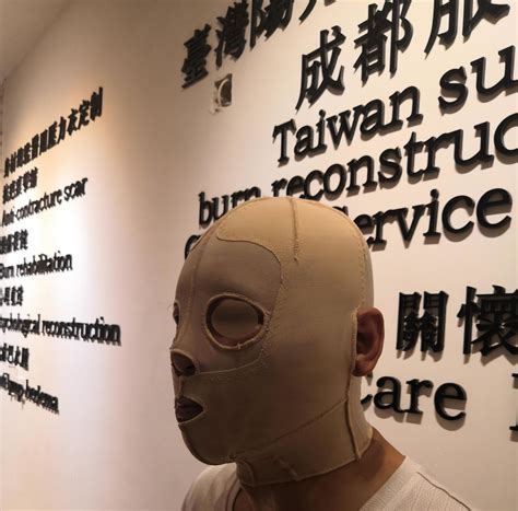 烧伤愈合：临床并发症、医疗护理、治疗和敷料类型：临床实践的知识现状 4 身材总监烧烫伤压力治疗 知乎