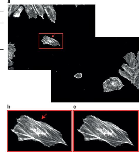 Figure 1 From Vignetting And Photo Bleaching Correction In Automated Fluorescence Microscopy