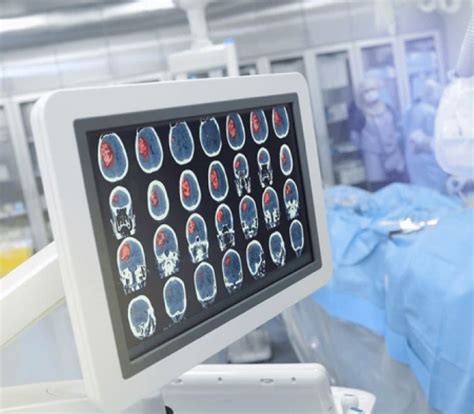 Stroke Unit Hitwardhak