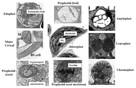 Plant Cell Leucoplast Tem