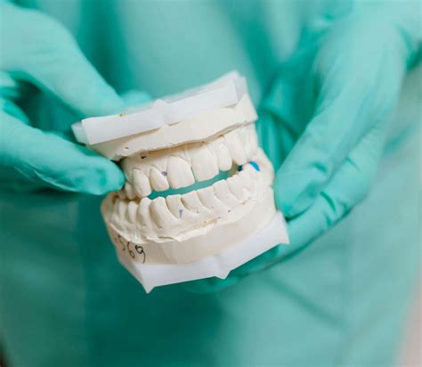 Everything You Should Know About Underbite Taft Hill Orthodontics