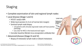 Merkel Cell Carcinoma From Diagnosis To Treatment Webinar Pptx