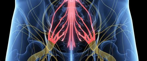 Understanding Cauda Equina Syndrome