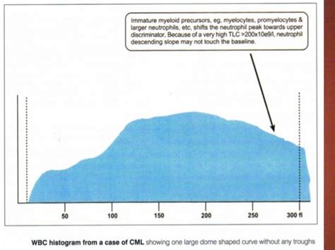 Cbc Histogram Dr Narmada Prasad Tiwari