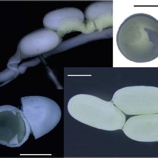 Eggs Of P Funiculum 12 Eggs Retained In Reproductive Tract Under