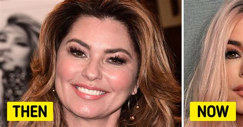 Shania Twain Deemed Unrecognizable After Her Face Shocked People In New Photos Bright Side