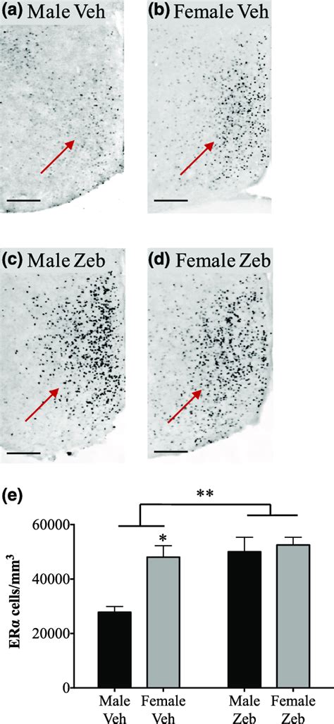 Neonatal Treatment With Zebularine Eliminates The Sex Difference In