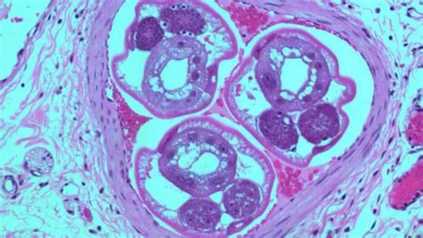 Angiostrongylus The Two Types Explained Scalar Light
