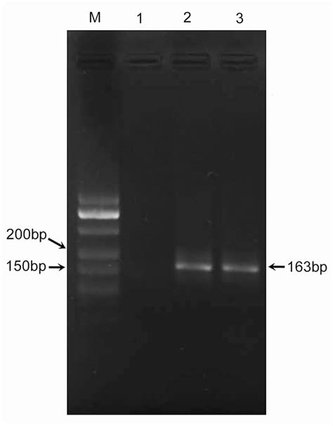 Novel Approach Based On One Tube Nested Pcr And A Lateral Flow Strip For Highly Sensitive