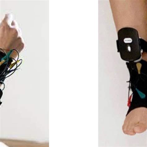 Example Of Neuromodulation Device Placement Of The Intervention And