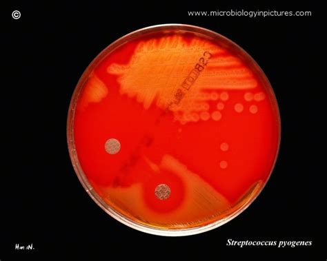 Streptococcus Pyogenes
