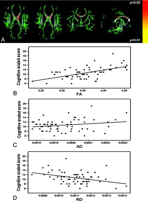 Neonatal Tract Based Spatial Statistics Findings And Outcome In Preterm