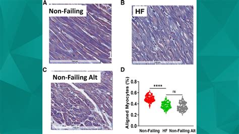 Analyzing Cardiac Tissue Function Aurora Scientific