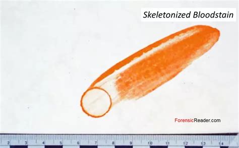 Bloodstain Pattern Analysis Forensic Types And Classification