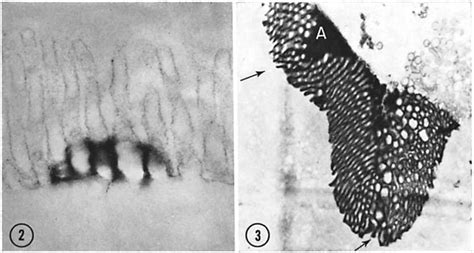 Patch Of Lanthanum Staining In Brush Border Showing Variation In Size