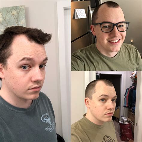 Buzz Cut Receding Hairline Before And After Reddit Best Men Haircuts 2025
