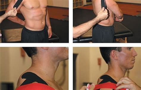 Shoulder Strategies Reduce Pain Improve Function With Proper Taping