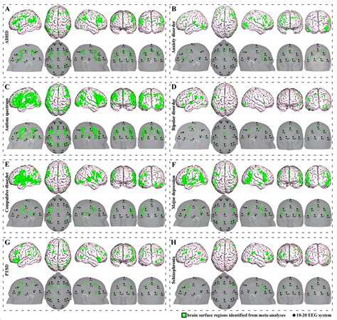 Brain Surface Regions For Scalp Stimulation For Mental Disorders Download Scientific Diagram