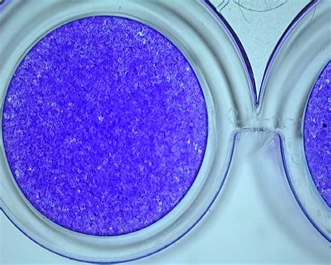 Machine Learning Based Automated Quantification Machine For Virus Plaque Assay Counting Peerj