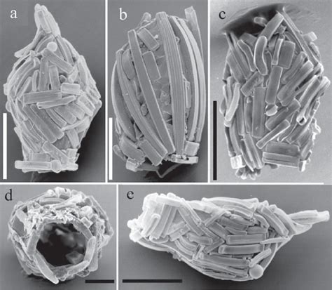 Different Specimens Of Difflugia Bacillariarum From C Ogden S SEM Download Scientific Diagram