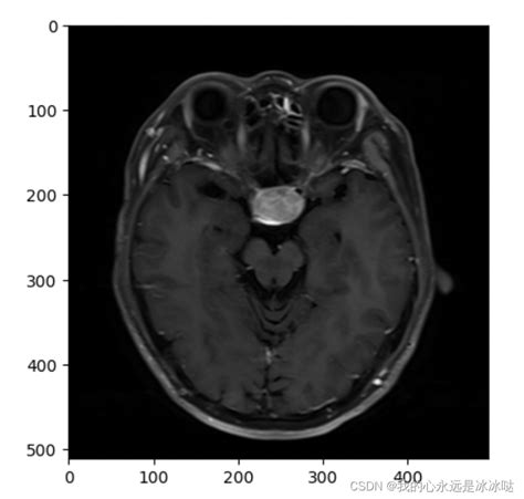 Dcm文件数据学习 Csdn博客