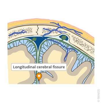 Longitudinal Cerebral Fissure E Anatomy Imaios