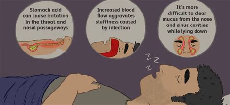 Blocked Nose What Could Be The Reason Healthy Food Near Me