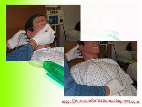 Nasogastric Tube Ngt Insertion And Removal Pps