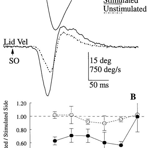 A B Comparison Of Trigeminal Reflex Blinks Evoked In The Eyelid