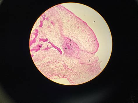 Bud Stage Diagram Quizlet