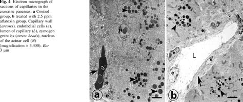Electron Micrograph Of Sections Of Capillaries In The Exocrine