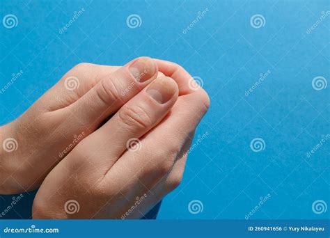 What Causes Nail Bed Separation At Kathleen Lynch Blog