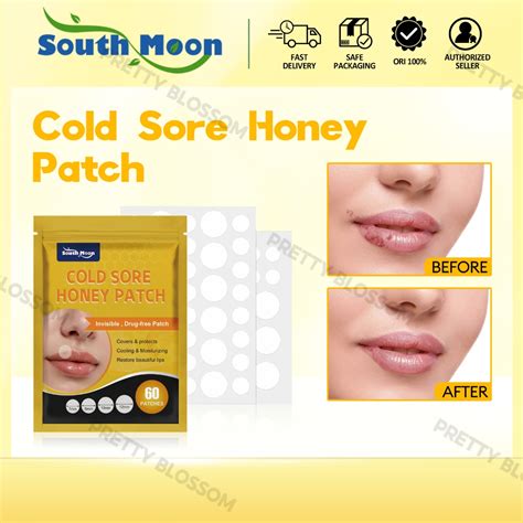 South Moon 60pcs Cold Sore Lip Patch Multifunctional Mouth Ulceration Blisters Herpes Sticker