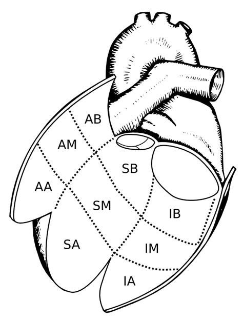 Localisation Of The Origin Of A Ventricular Tachycardia Ecgpedia