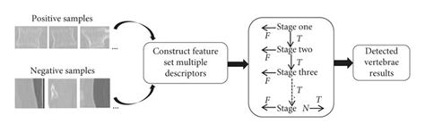 Schematic Of The Cascade Gentle Adaboost Detector Download