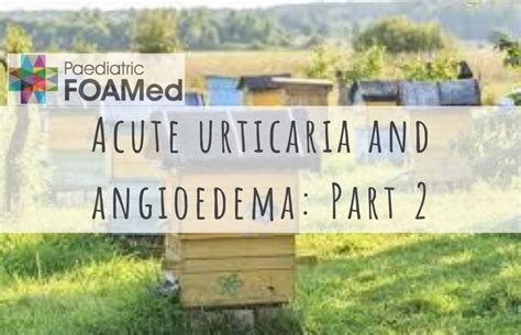 Acute Angiodema And Urticaria Part 2 Paediatricfoam