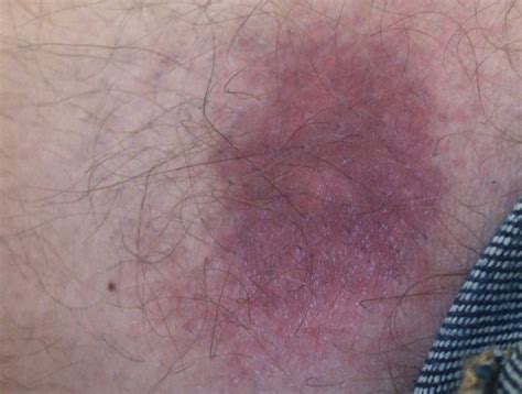 Is Dit Een Daas Medische Forum Dokternl