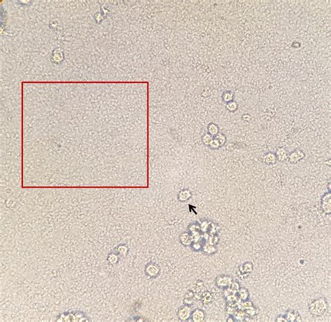 43 Questions With Answers In Thp 1 Cells Science Topic