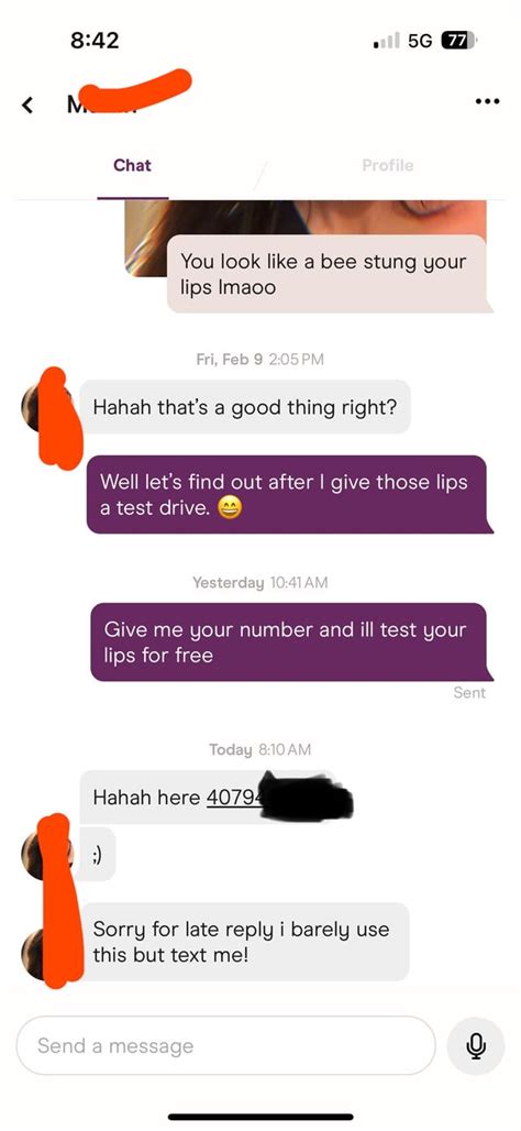 Bee Sting Lips Rgreatconvodump